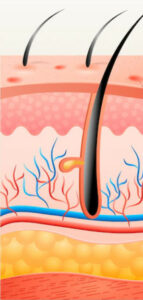 Pelos encravados: O que são e como tratar? - Attica